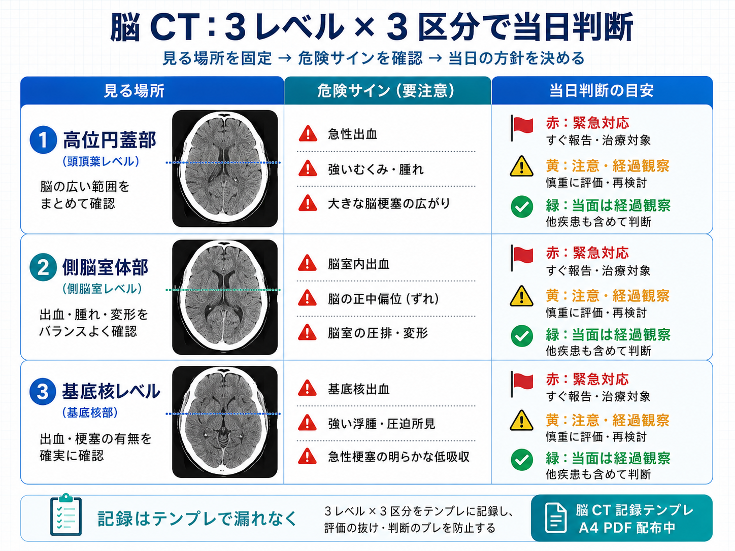 脳 CT スライスレベルの見方｜新人 PT の確認順 | リハビリくん